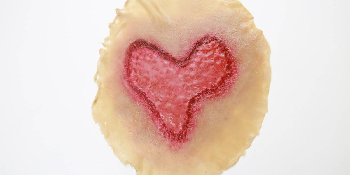 Anatomy Lab Moulage - Boil — Pristine Medical