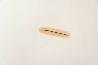 Anatomy Knife Injury Moulage for Simulation – Pristine Medical