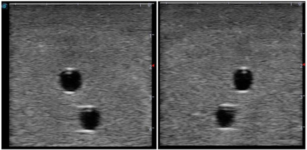 Ultrasound Vascular Access Training Model - Pristine Medical
